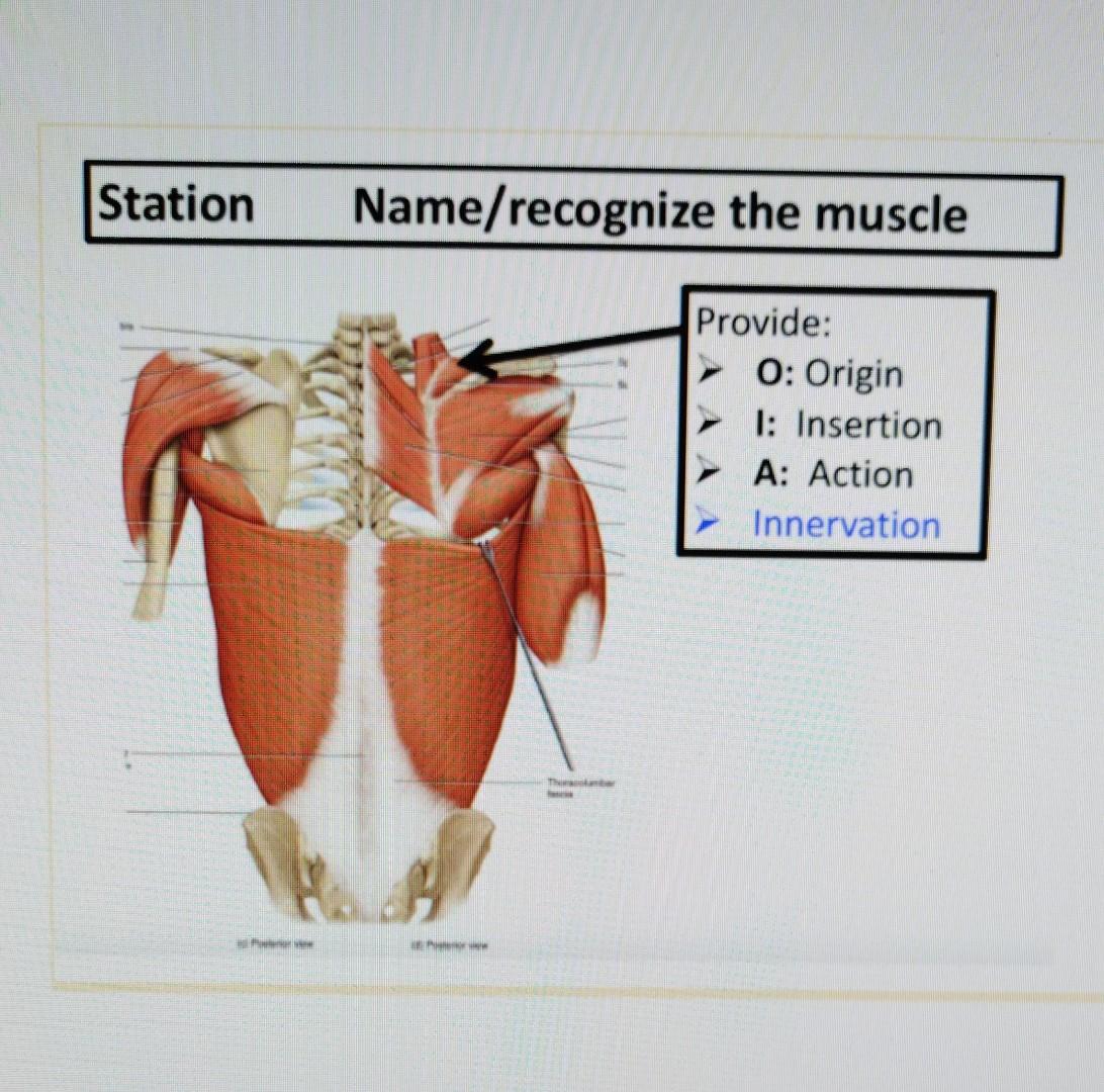 Solved scles Station Name/recognize the muscle | Chegg.com