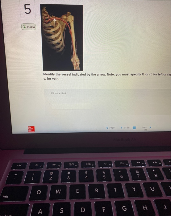Solved Identify the vessel indicated by the arrow. Note: you | Chegg.com