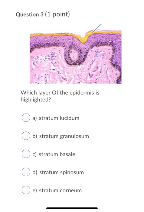 Solved Question 3 (1 point) Which layer of the epidermis is | Chegg.com