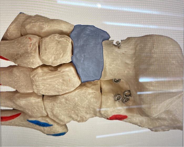 Solved Cuboid Lateral cuneiform Navicular Intermediate | Chegg.com