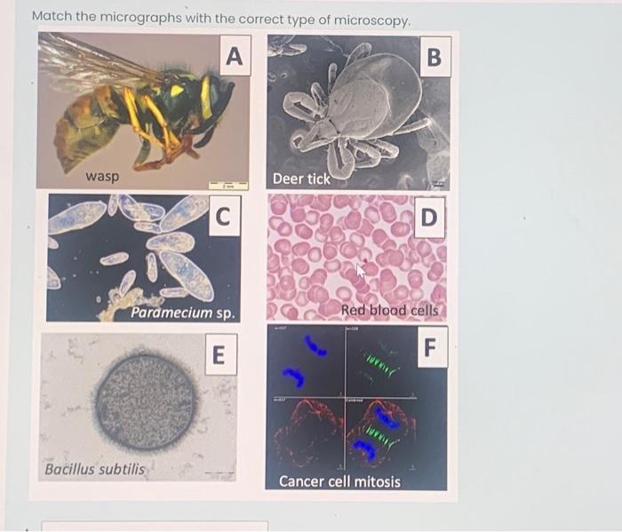 Solved Match the micrographs with the correct type of | Chegg.com