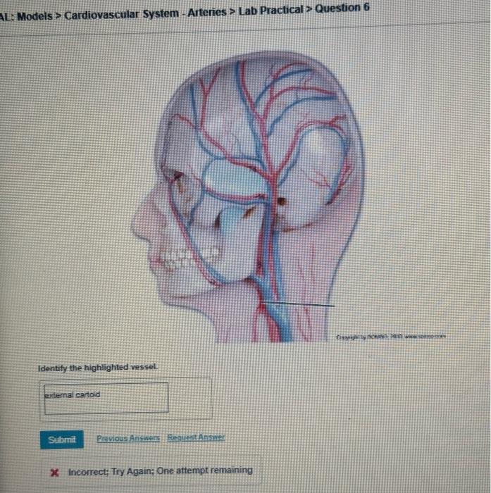 Solved PAL: Models > Cardiovascular System-Arteries > Lab | Chegg.com