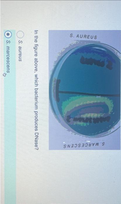 Solved In the figure above, which bacterium produces DNase? | Chegg.com