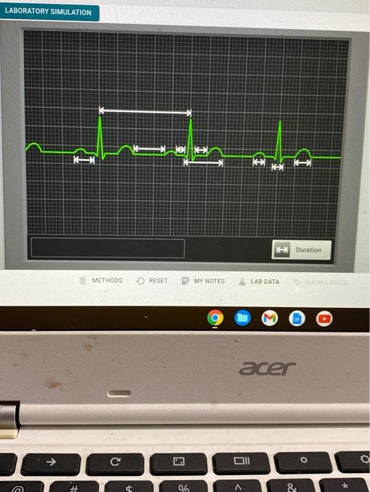 PHASE 3: Measure ECG - sitting at rest Complete the | Chegg.com
