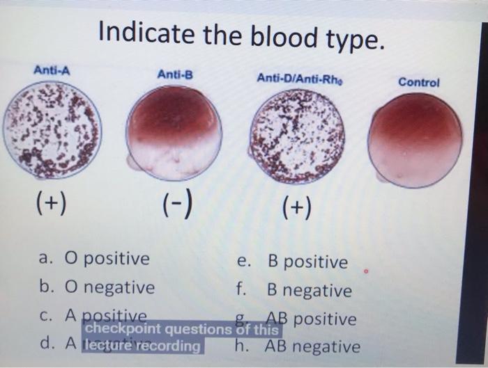 Solved Indicate the blood type. Anti-A Anti-B | Chegg.com