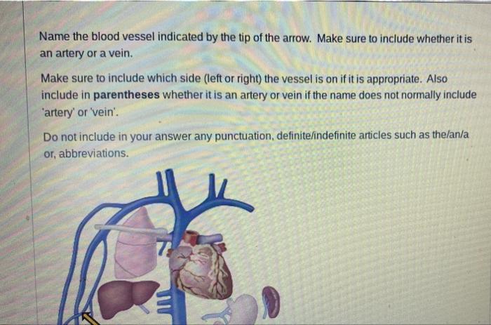 Solved Name the blood vessel indicated by the tip of the | Chegg.com