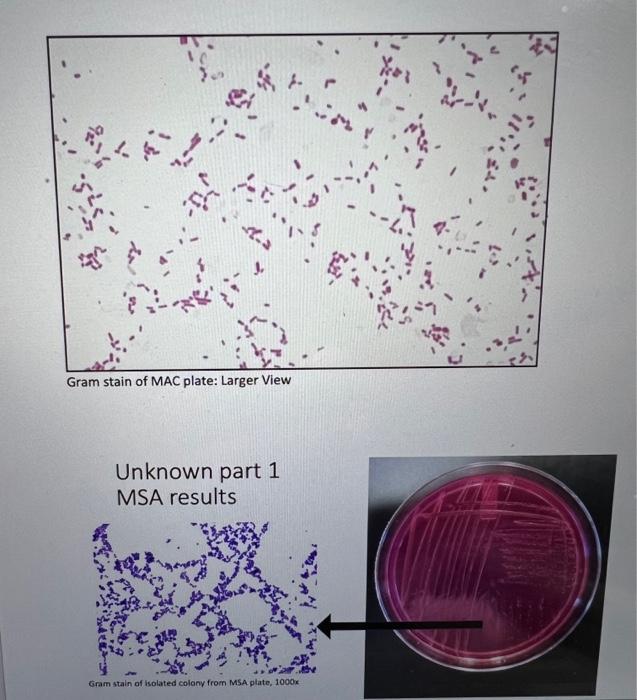 Solved Unknown sample number: 5 1. TSA plate gram stain | Chegg.com
