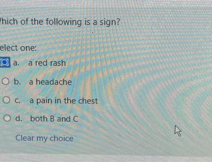 Solved Which of the following is a sign? elect one: Ola a | Chegg.com