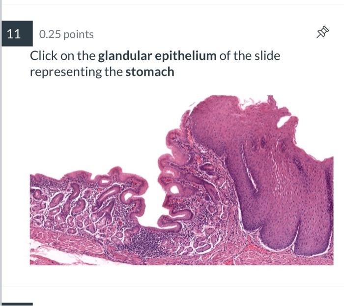 Solved 0.25 points Click on the glandular epithelium of the | Chegg.com