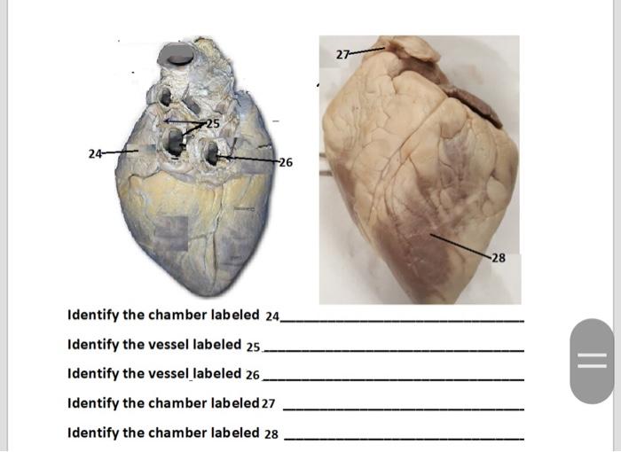 Solved 27- -25 24- 26 -28 Identify the chamber labeled 24- | Chegg.com