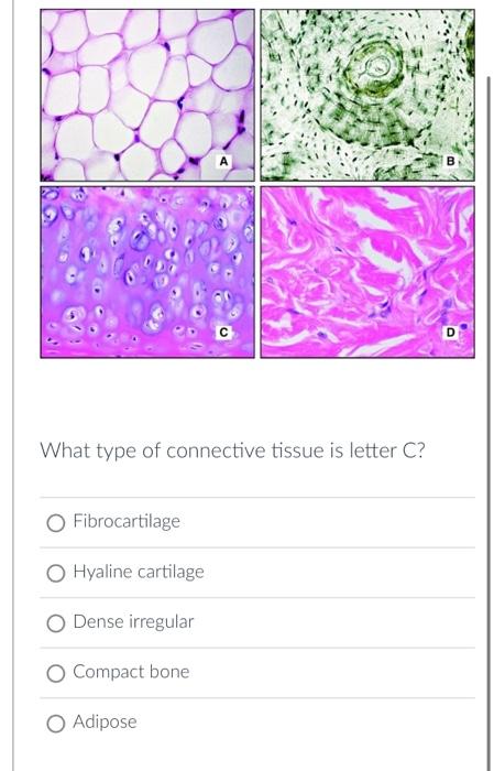 Solved What type of connective tissue is letter C ? | Chegg.com