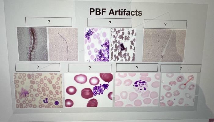 Solved PBF Artifacts | Chegg.com