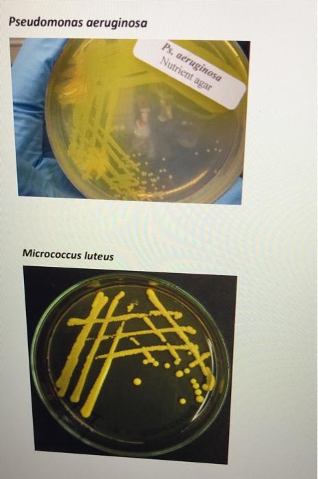 Solved Results A: Staphylococcus aureus on MSA Micrococcus | Chegg.com