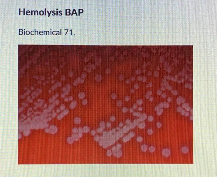 Solved Hemolysis BAP Biochemical 71. | Chegg.com