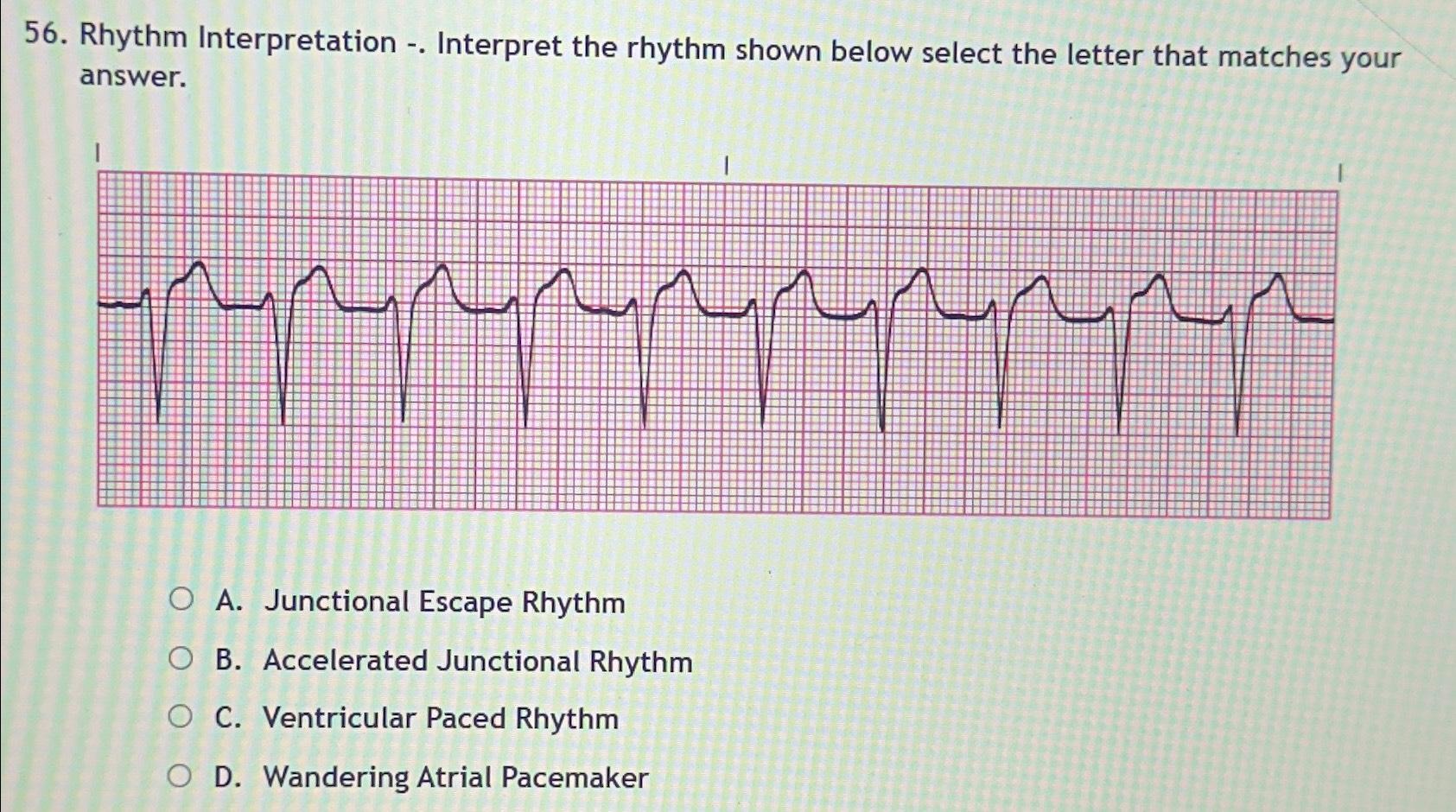 Solved Rhythm Interpretation -. ﻿Interpret the rhythm shown | Chegg.com