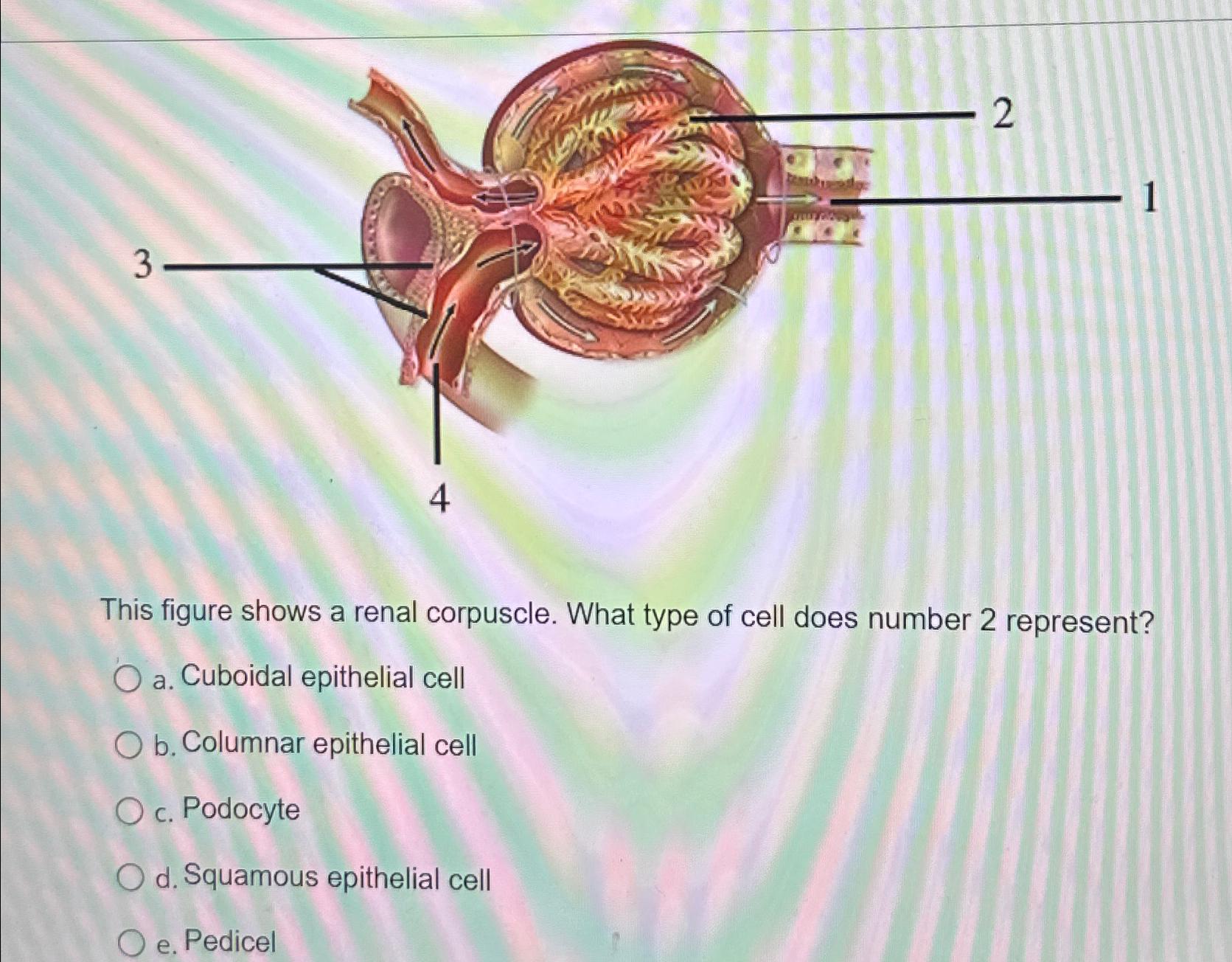 Solved This figure shows a renal corpuscle. What type of | Chegg.com