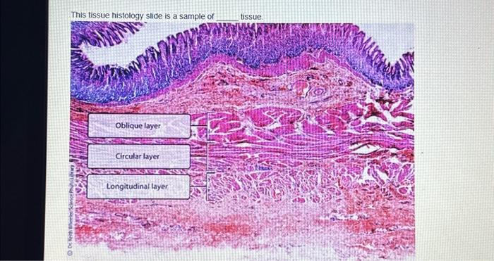 Solved This tissue histology slide is a sample of tissue. | Chegg.com