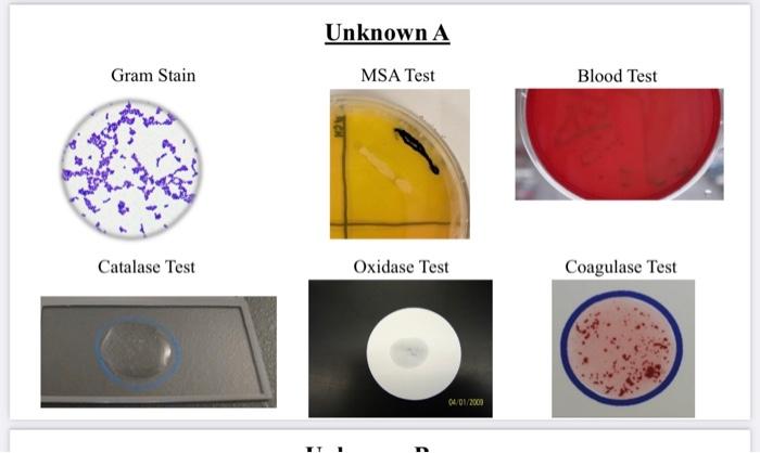 Unknown A Gram Stain MSA Test Blood Test Catalase | Chegg.com