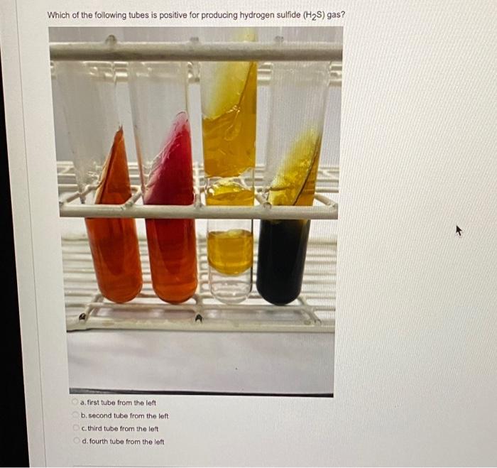 Solved Which of the following motility test tubes is | Chegg.com