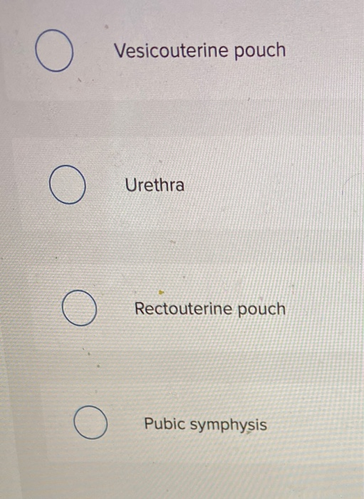 Solved H10 Female Pelvis 3B Scientific GmbH, Germany, 2017 | Chegg.com