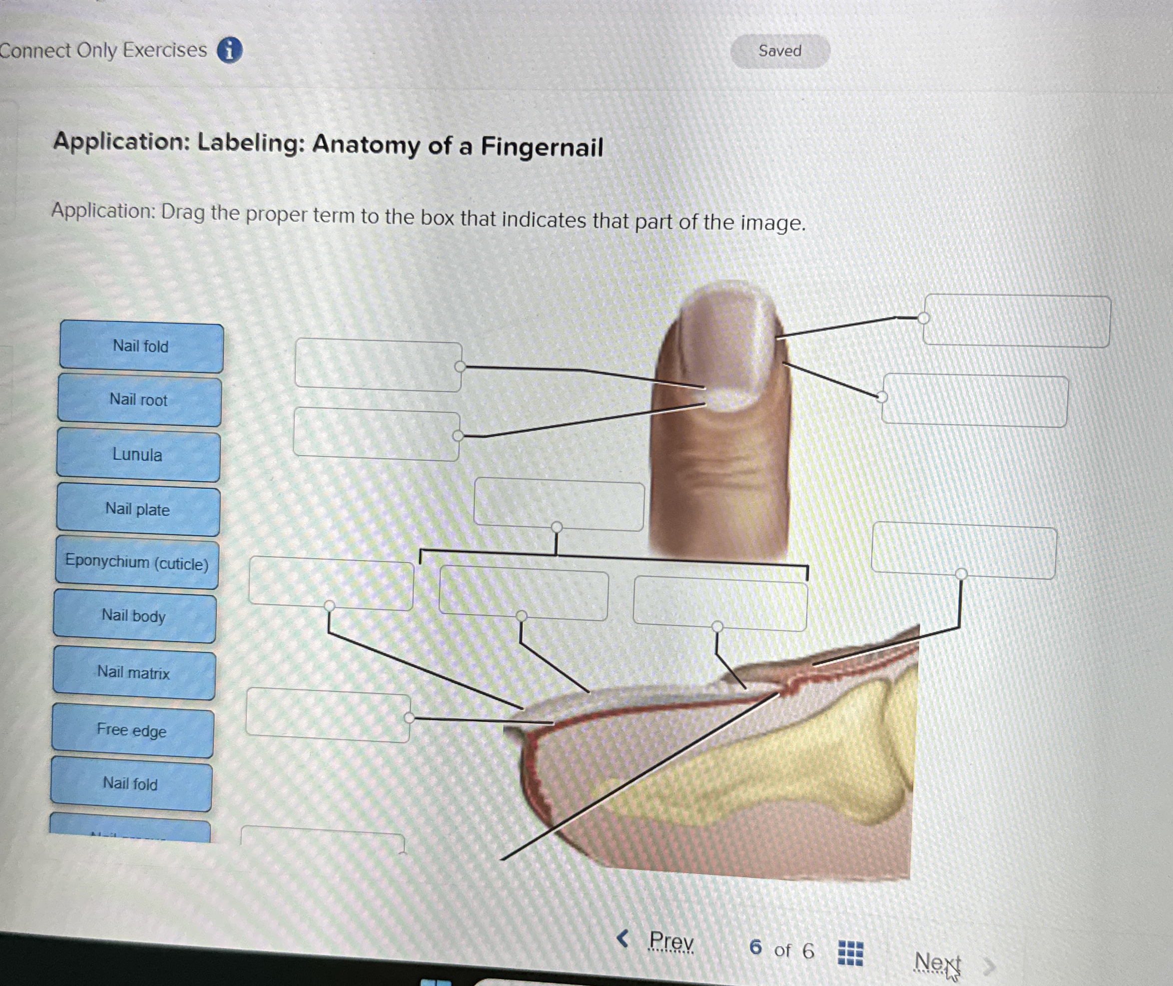 Solved Application: Labeling: Anatomy of a | Chegg.com