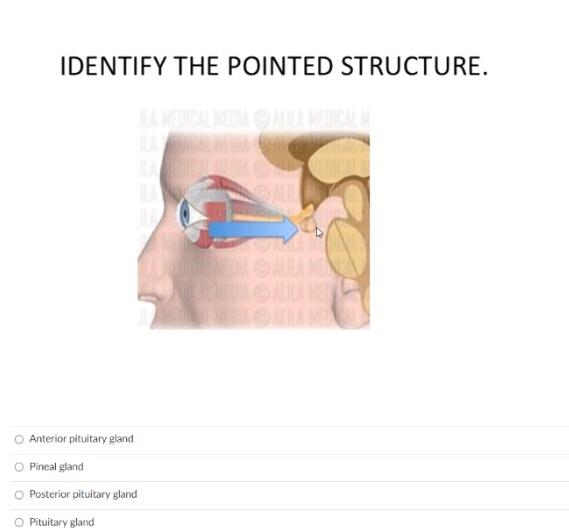 Solved IDENTIFY THE STRUCTURE POINTED. Hypothalamus Thalamus | Chegg.com