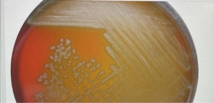 Solved 1. Using the MSA plate, coagulase test and novobiocin | Chegg.com