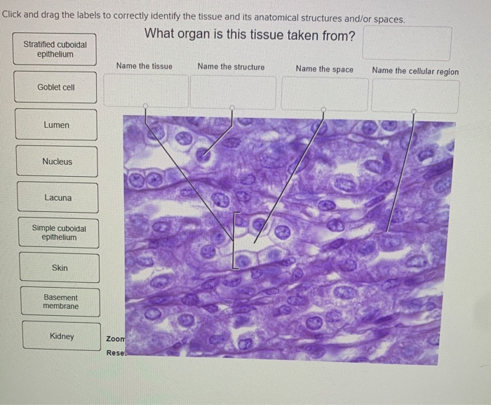 Solved Click and drag the labels to correctly identify the | Chegg.com