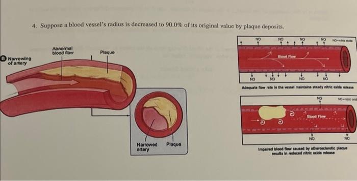 Solved Suppose a blood vessel's radius is decreased to 90.0% | Chegg.com