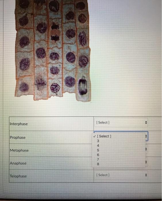 Solved In the image below you can see a group of 32 cells | Chegg.com
