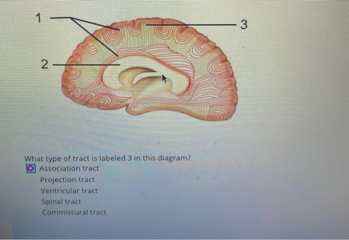 Solved 1 1 3 2. What type of tract is labeled 3 in this | Chegg.com