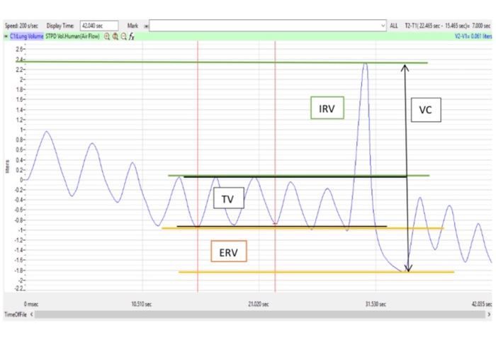 Solved From the image, calculate tidal volume (TV), | Chegg.com
