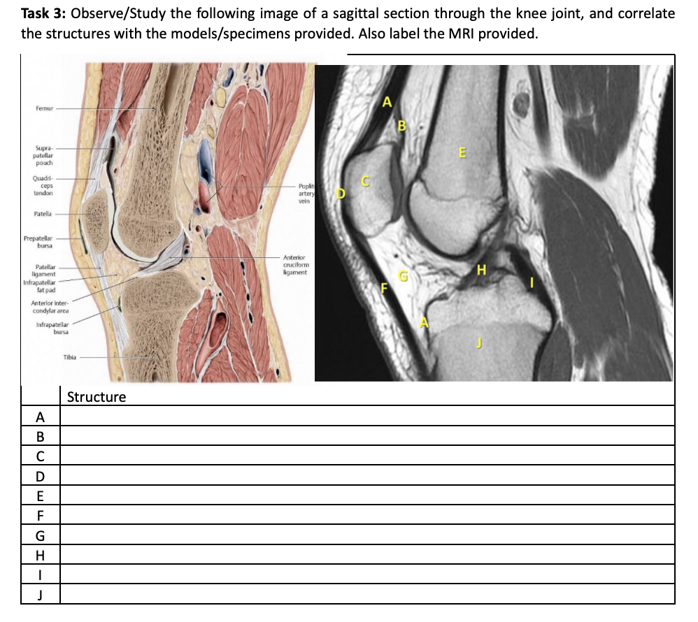Solved Task 3: Observe/Study the following image of a | Chegg.com