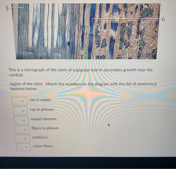 Solved 1 2 5 3 3 This is a micrograph of the stem of a | Chegg.com