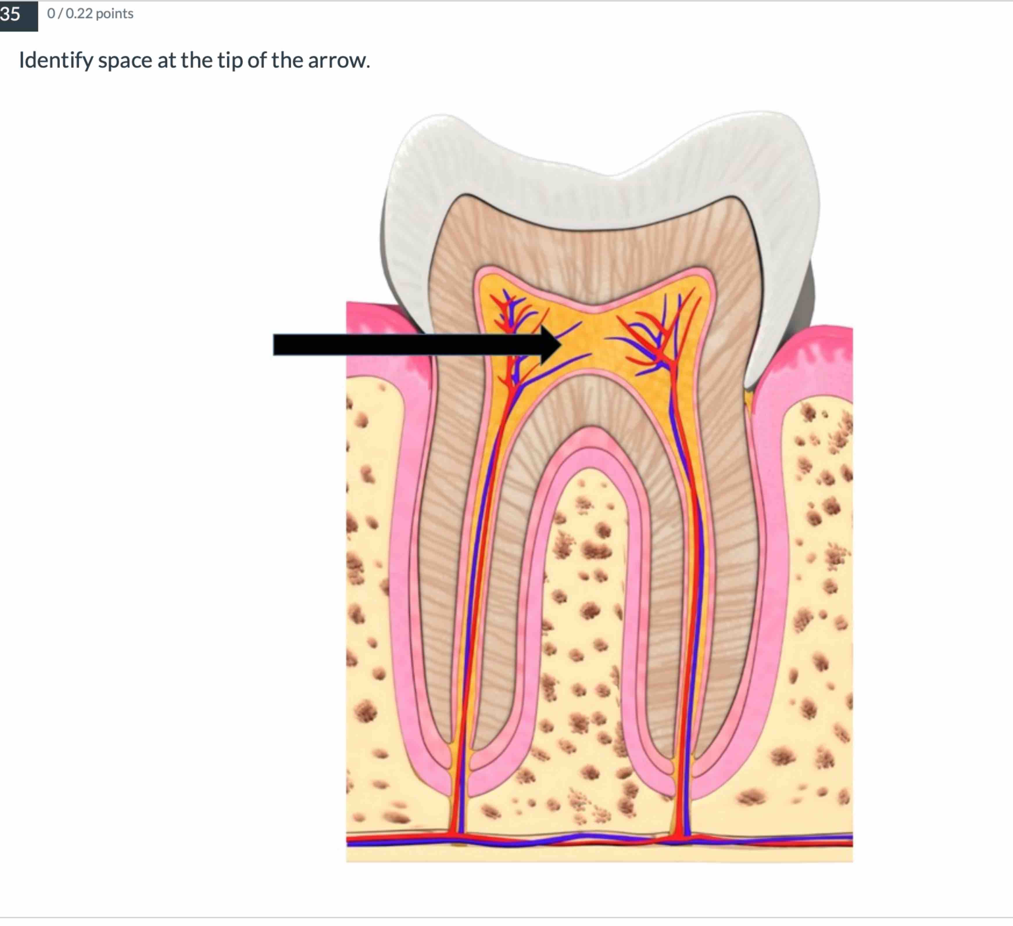 Solved Identify space at the tip of the arrow. | Chegg.com