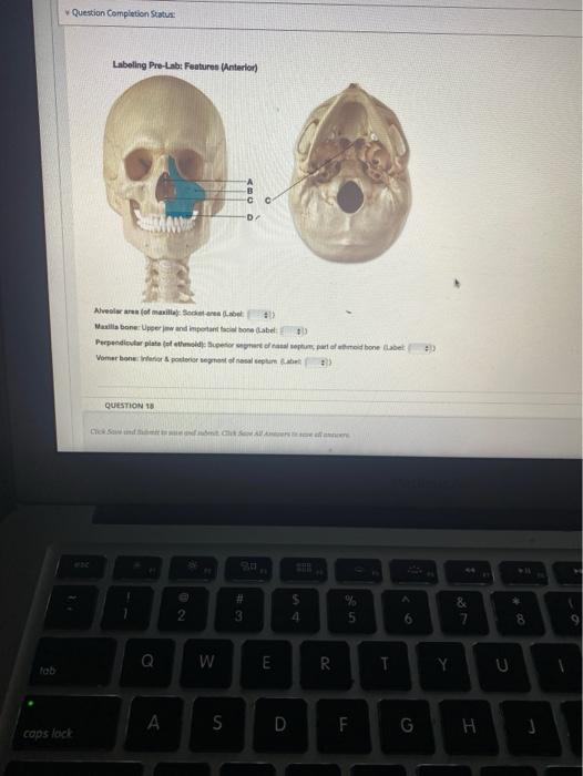 Solved QUESTION 7 Labeling Pre-Lab: Features of Cranial | Chegg.com