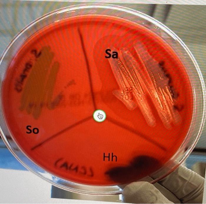 Solved B.CNA-blood Plate vs. Chocolate Agar: Growth and | Chegg.com