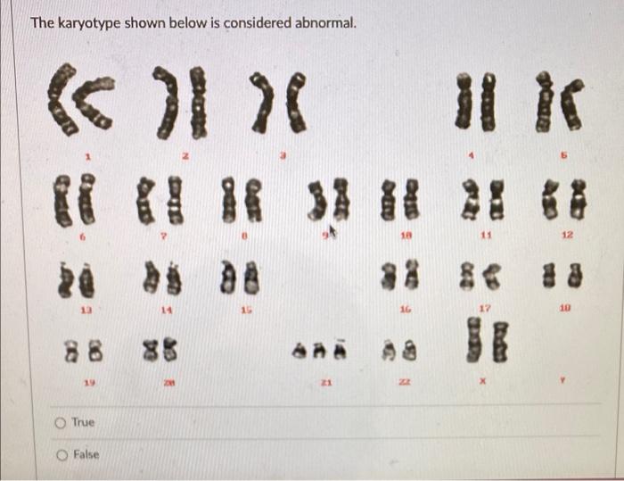 Solved The karyotype shown below is considered abnormal. | Chegg.com