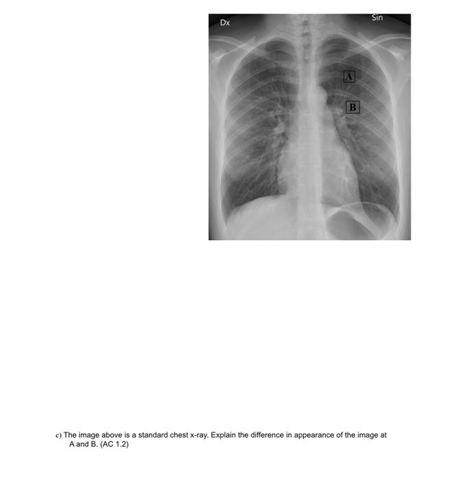 c) The image above is a standard chest x-ray. Explain | Chegg.com