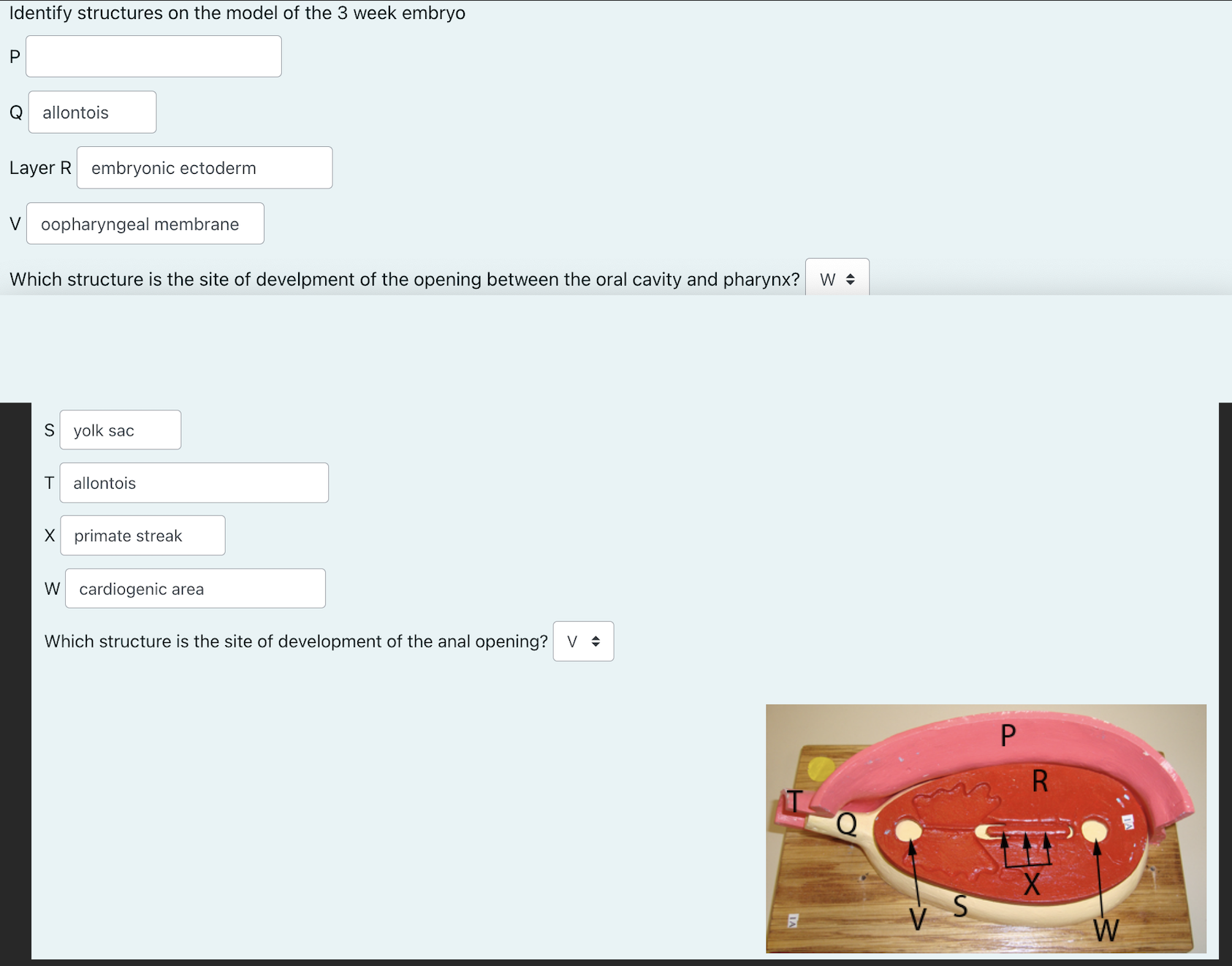Solved Identify structures on the model of the 3 ﻿week | Chegg.com