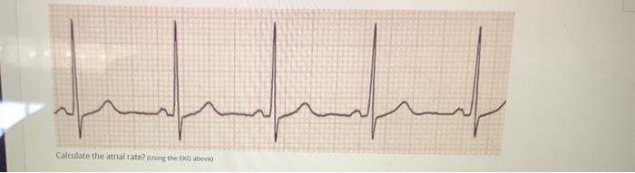 Solved and Calculate the atrial rate using the above) | Chegg.com
