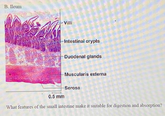 Solved B. lleum Villi Intestinal crypts Duodenal glands | Chegg.com