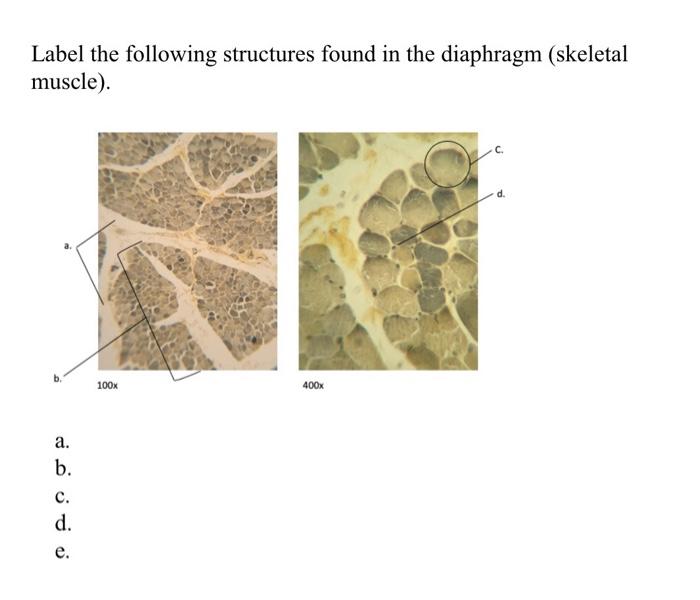 Solved Label the following structures found in the diaphragm | Chegg.com