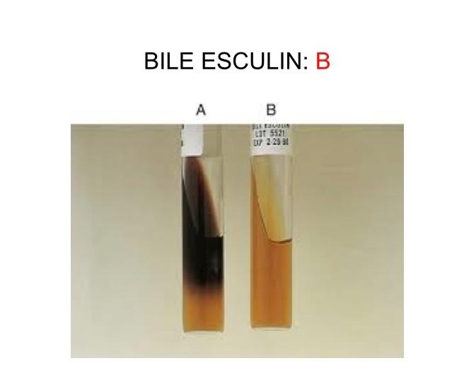 Solved BILE ESCULIN: B А B a VII LIT 5521 BY 2.2931 | Chegg.com