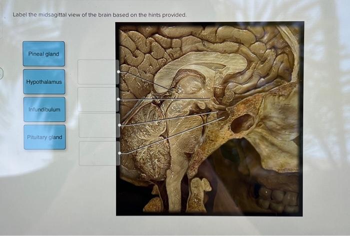 Solved Label the midsagittal view of the brain based on the | Chegg.com