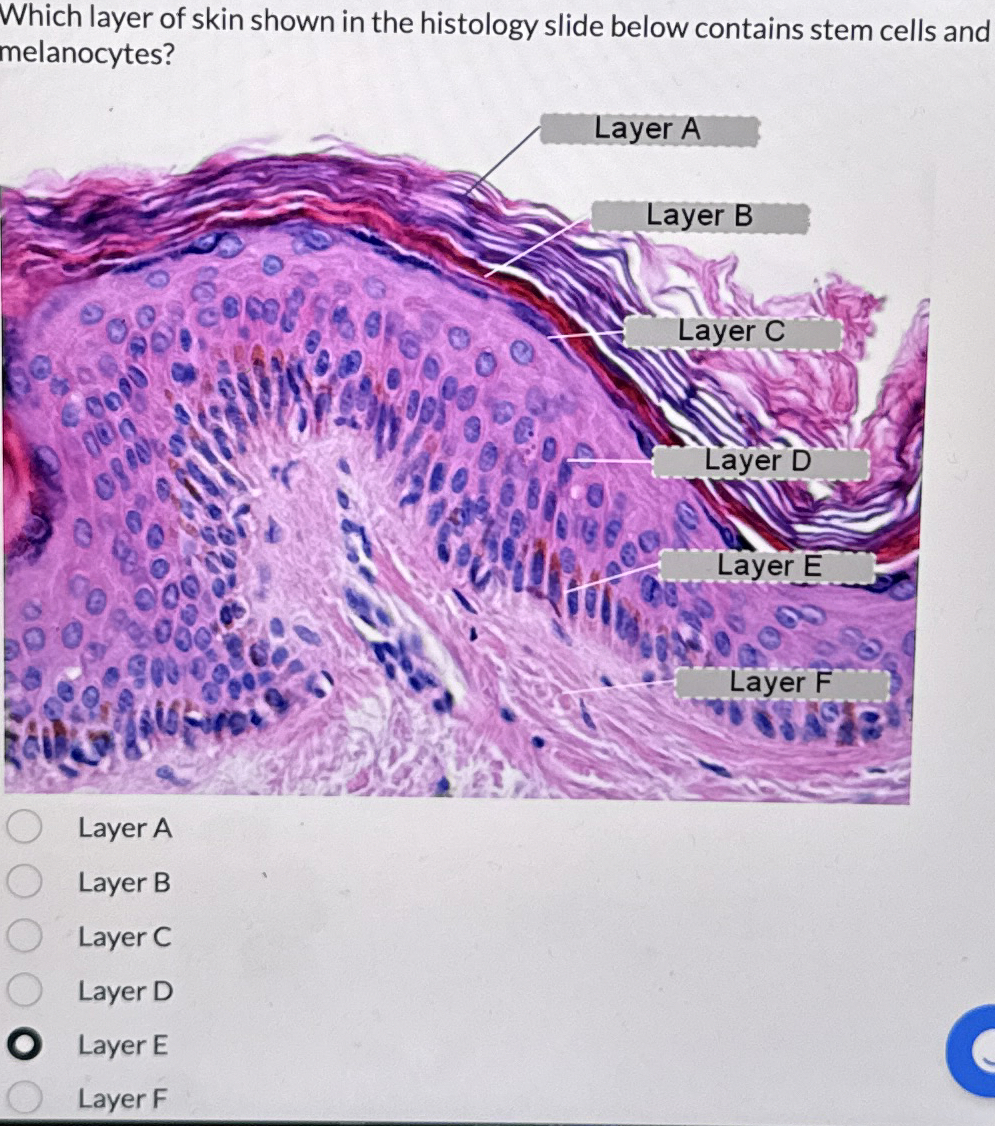 Solved Which layer of skin shown in the histology slide | Chegg.com