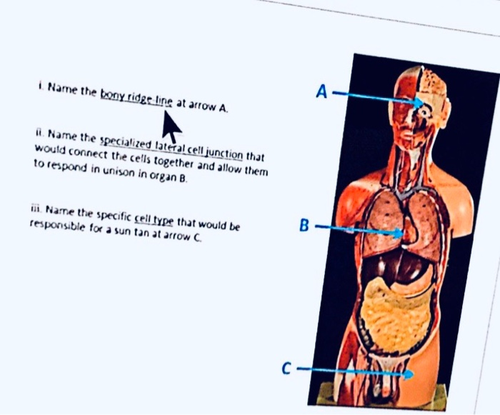 Solved Name the bony ridge line at allow A. A Name the | Chegg.com