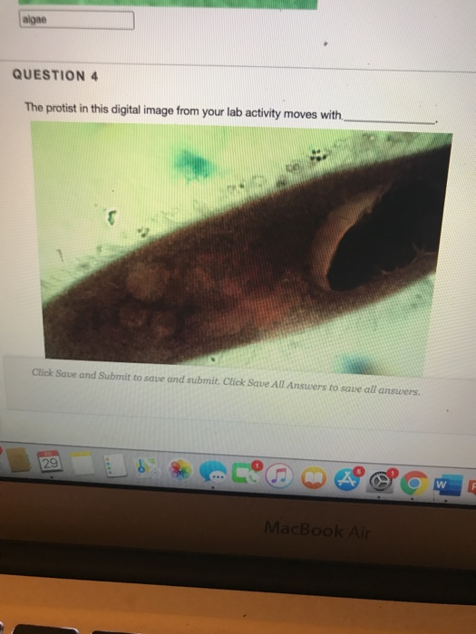 Solved the protist in this digital image from your lab | Chegg.com