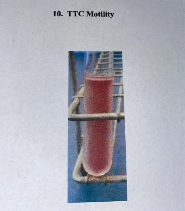 Solved 10. TTC Motility 5 Motility Media Used and | Chegg.com