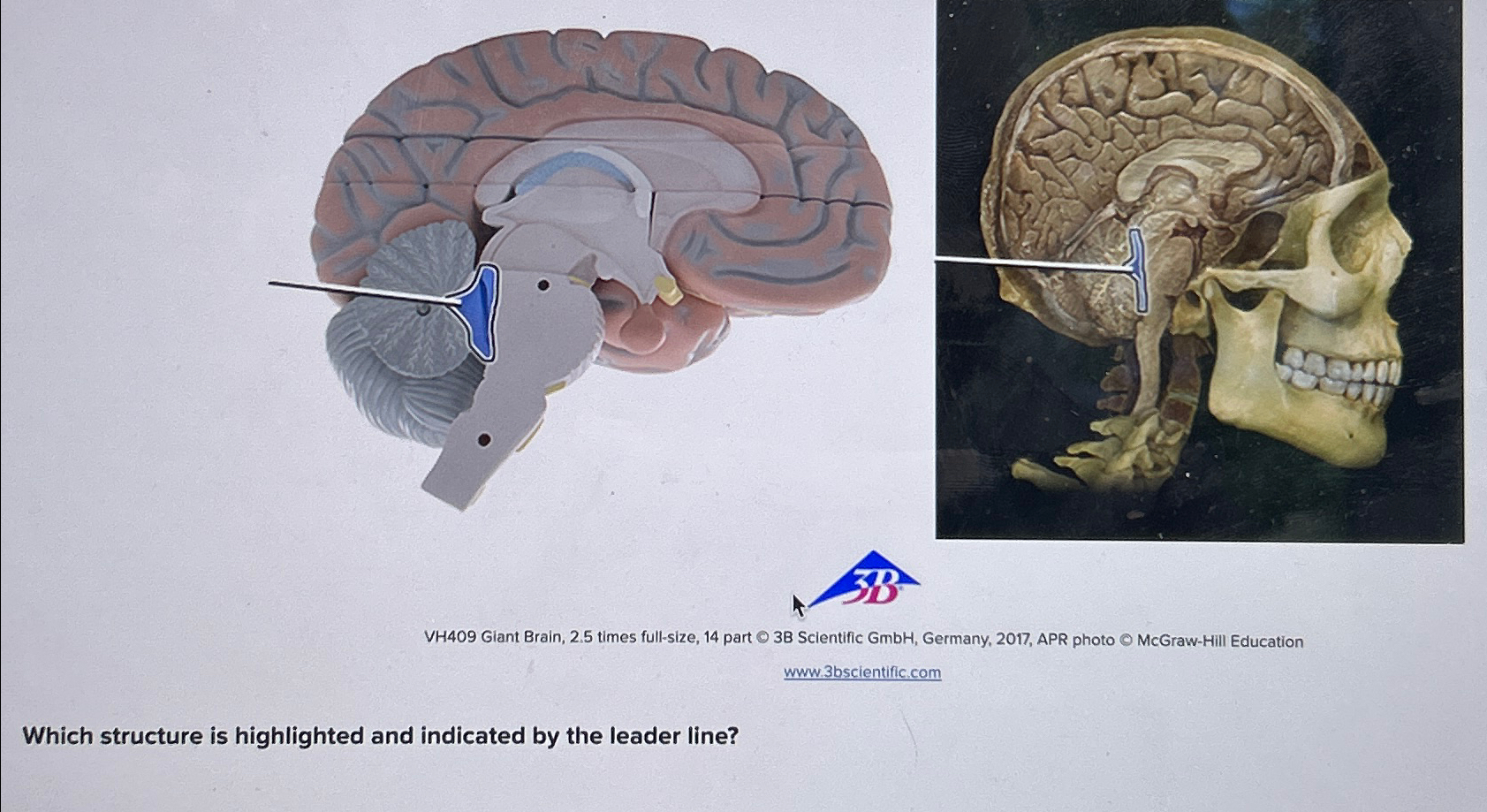 Solved VH409 ﻿Giant Brain, 2.5 ﻿times full-size, 14 ﻿part | Chegg.com